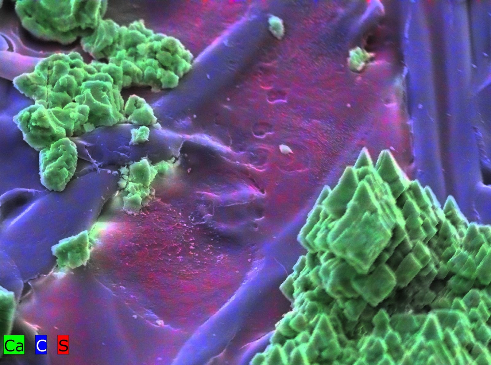 Membrane Autopsy with CEI℠ - Avista™